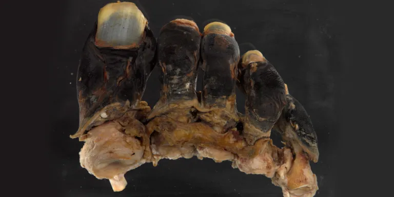 ‘Bronco’ Lane: Everest adventurer | National Army Museum